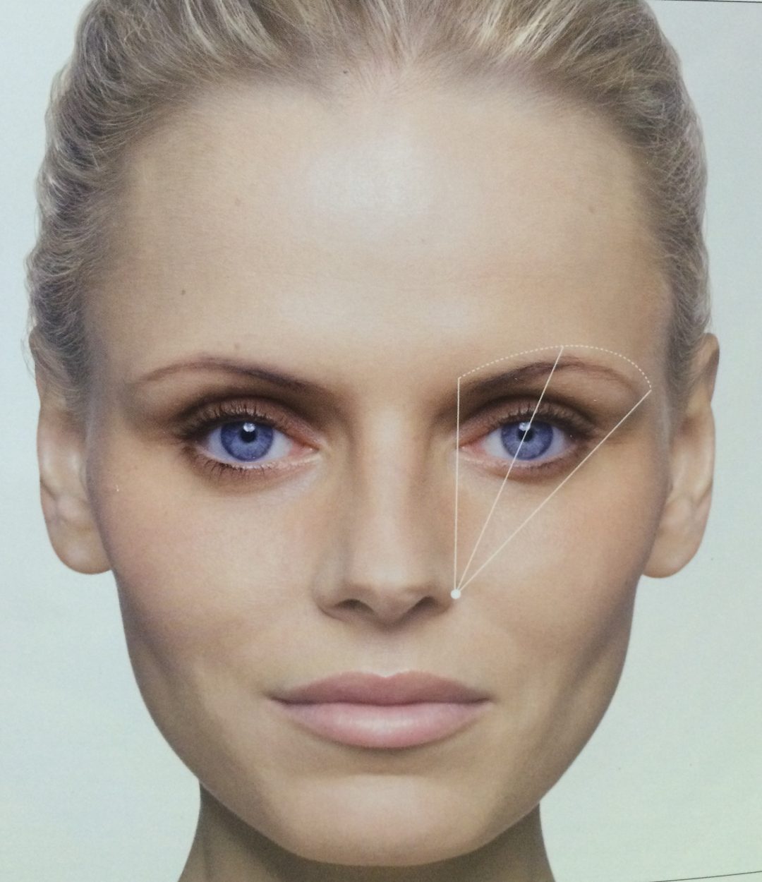 TÉCNICAS PARA ELEVAR LAS CEJAS - Carmen Traseira, medicina estética en ...